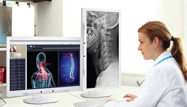 Philips inova com monitores que avaliam exames na tela